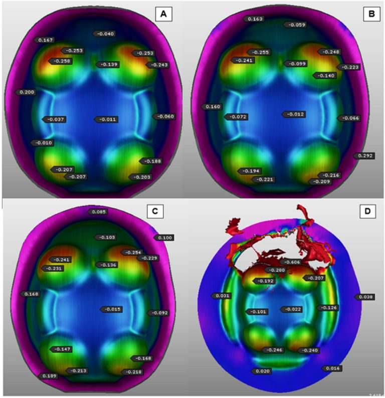 In Pictures! How Hydroforming Can Replace Sheet Metal Stamping in the ...